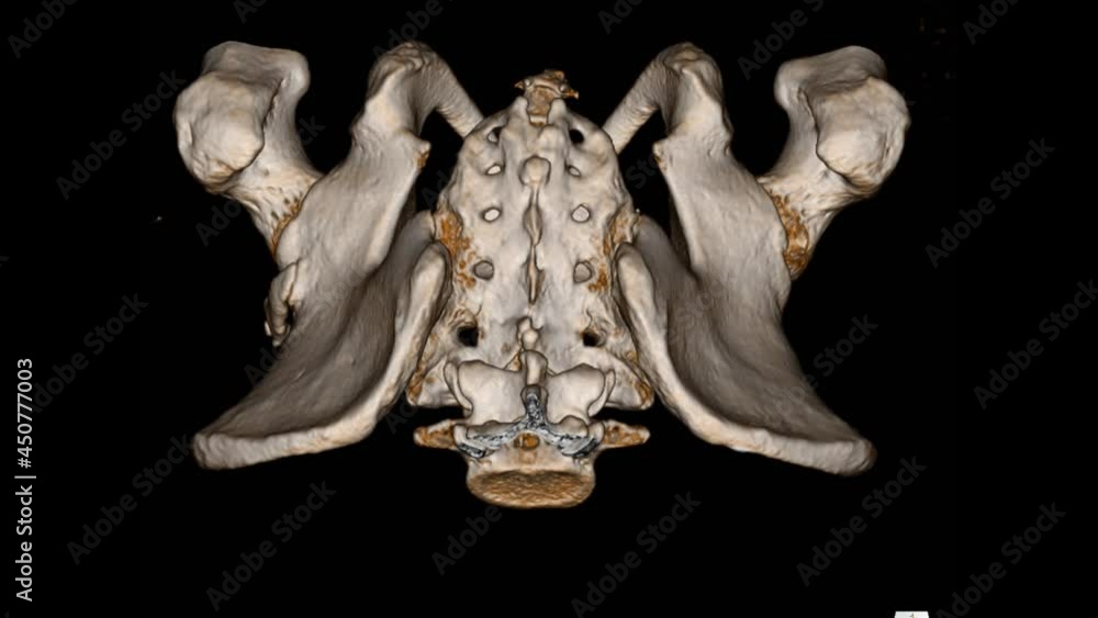 CT Pelvis Bone 3D rendering image isolated on a black background ...