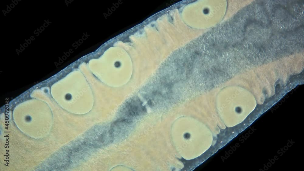 Worm Nemertea Prostoma sp. under microscope, of Tetrastemmatidae family ...