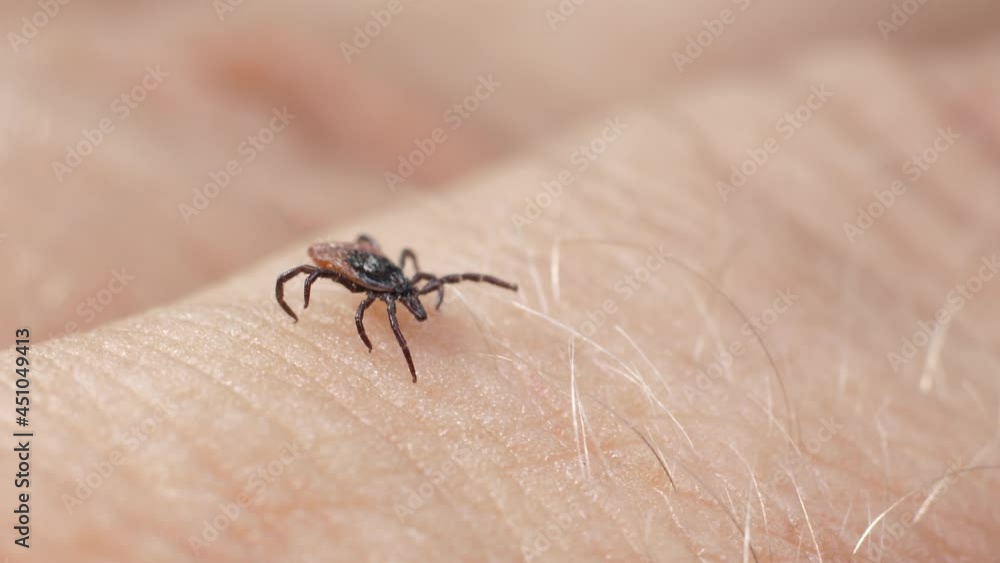 The mite crawls on human skin. Harvest-bug tries to bite a person ...