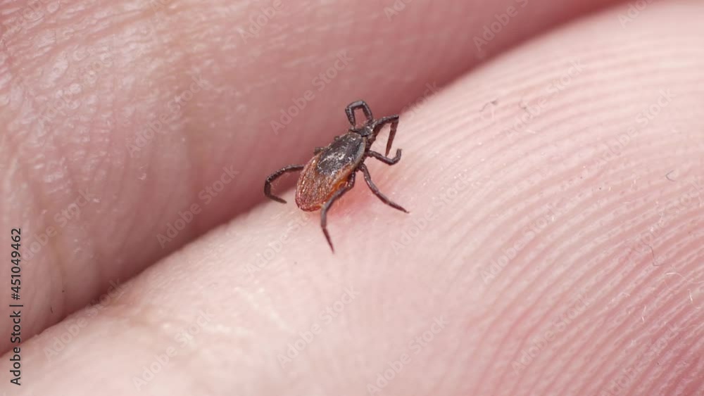 The mite crawls on human skin. Harvest-bug tries to bite a person ...