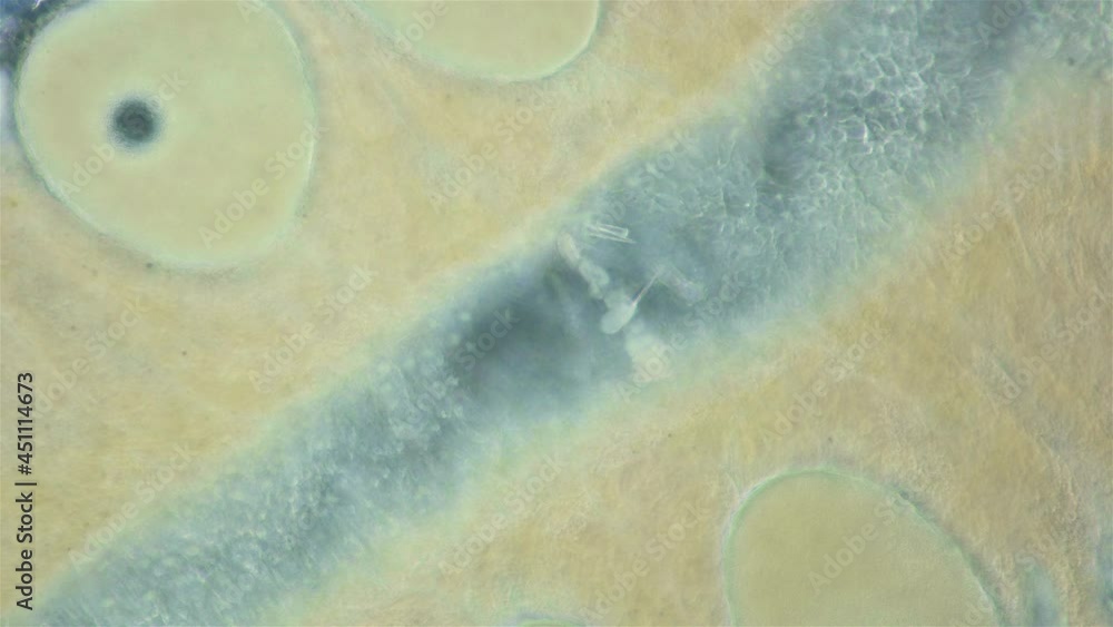 Worm Nemertea Prostoma sp. under microscope, of Tetrastemmatidae family ...