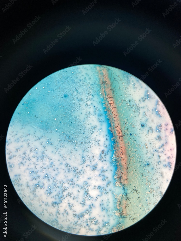 closeup photo of blood smear under microscope Stock Photo | Adobe Stock