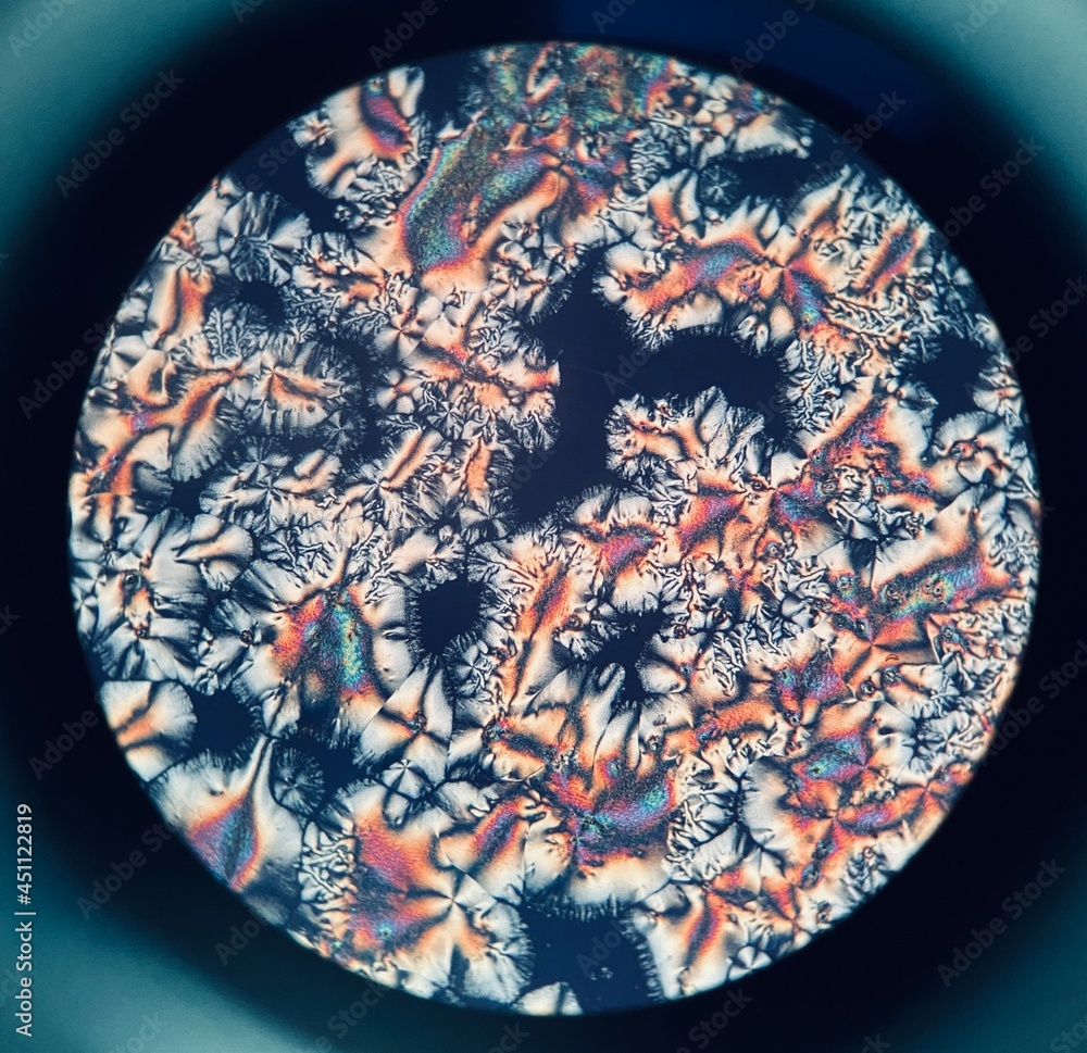 ascorbic acid crystals under microscope Stock Photo | Adobe Stock