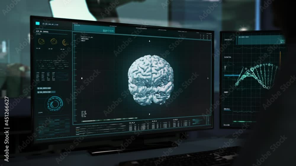 Brain Scan Analyzed In Advanced Medical Software At Neurosurgery ...