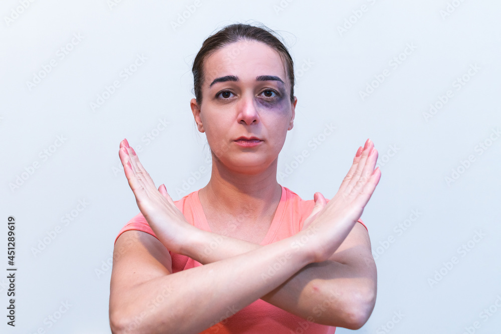 woman shows her hands STOP. harassment concept. woman with a bruise on ...