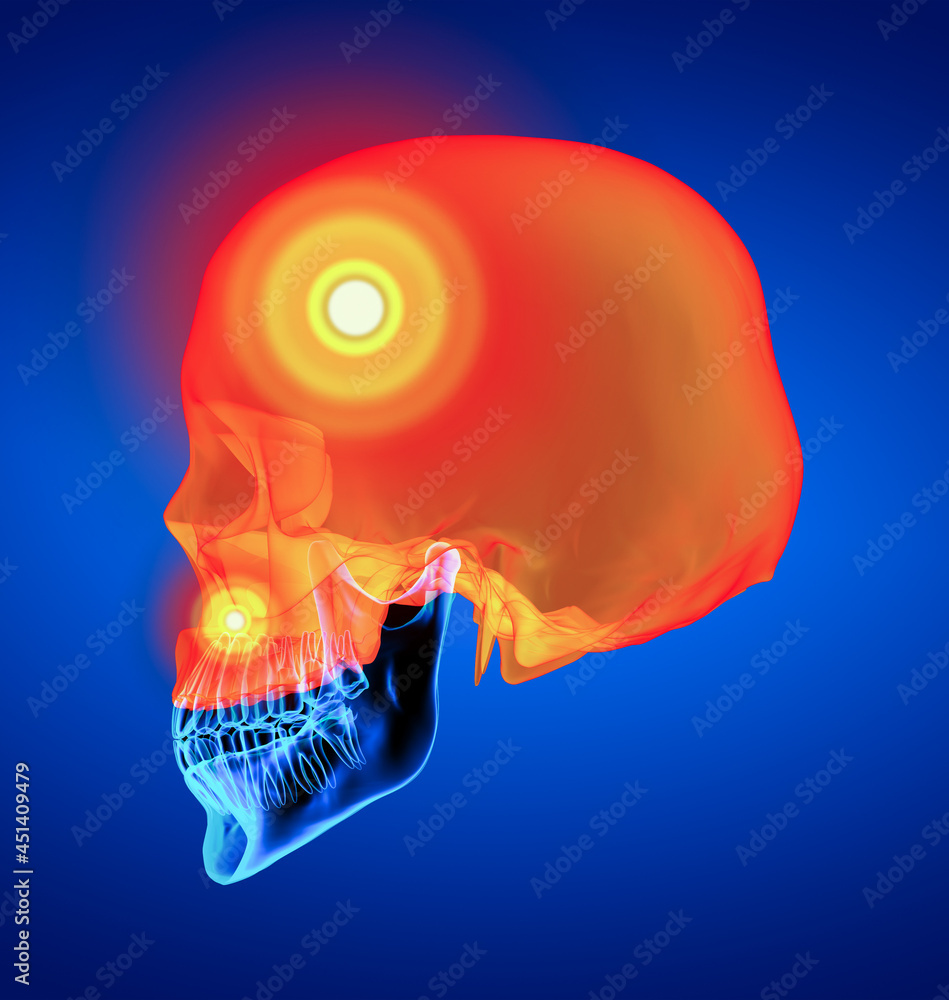 Human Skull. Upper half. with black background - side view Stock ...