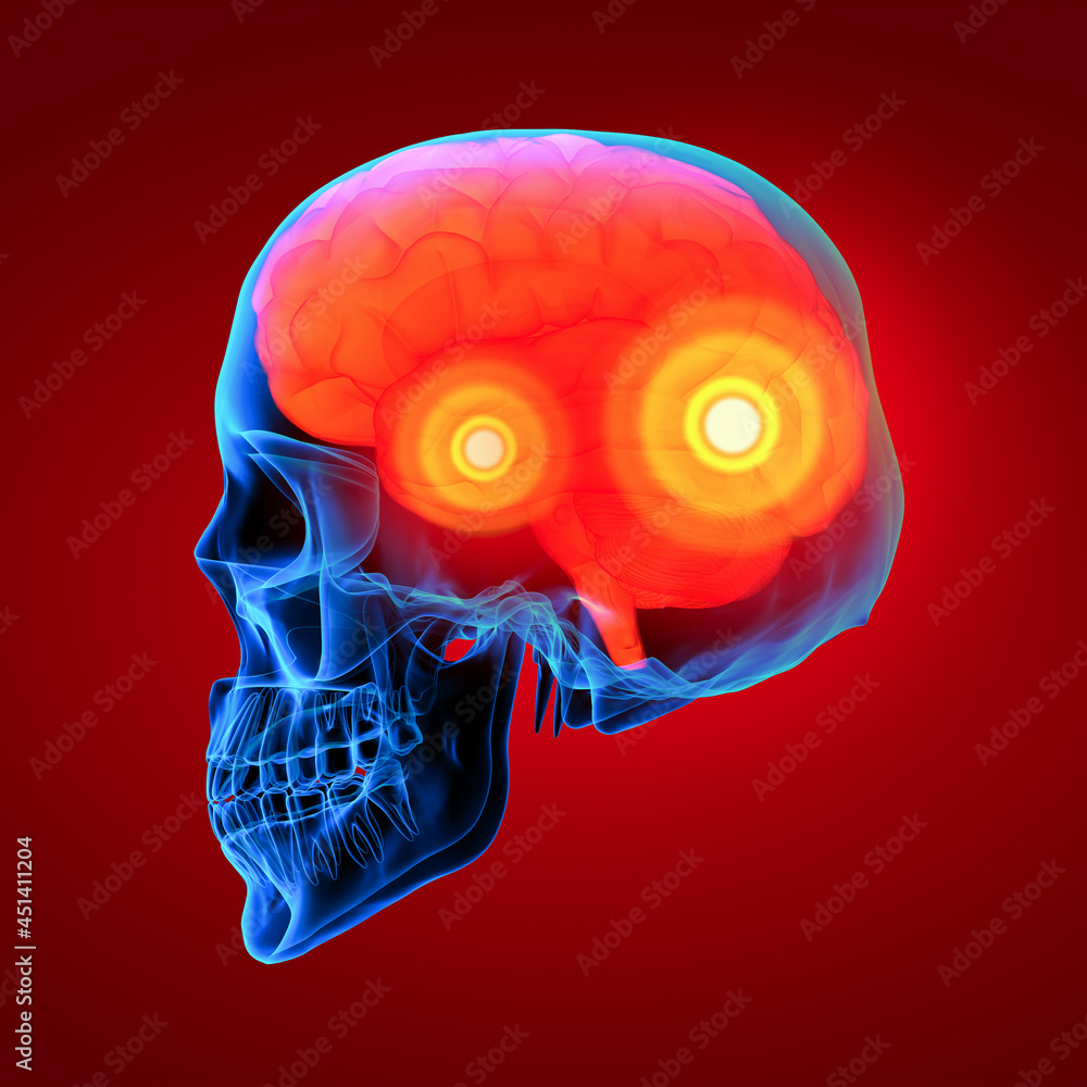 Human red brain X ray - side view Stock Illustration | Adobe Stock