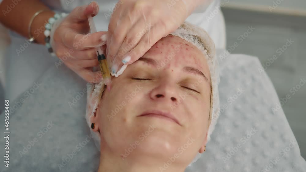 The doctor makes injections of blood plasma into the face of a female ...