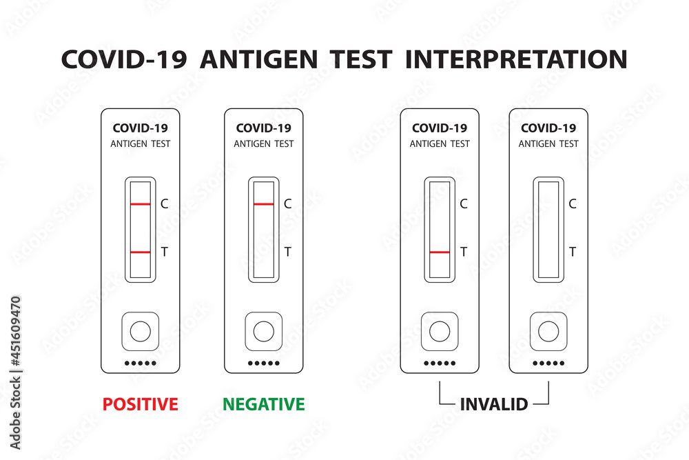 Interpretation of Covid-19 antigen test results. The chart explains the ...