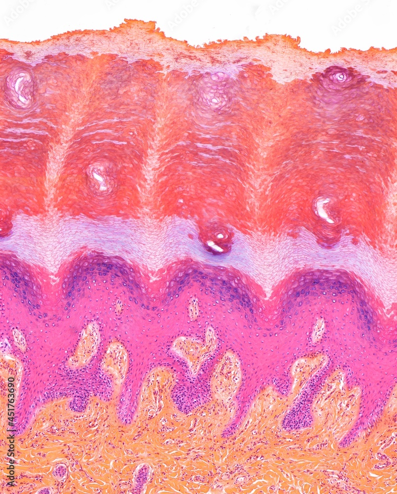 Plantar skin, LM Stock Illustration | Adobe Stock