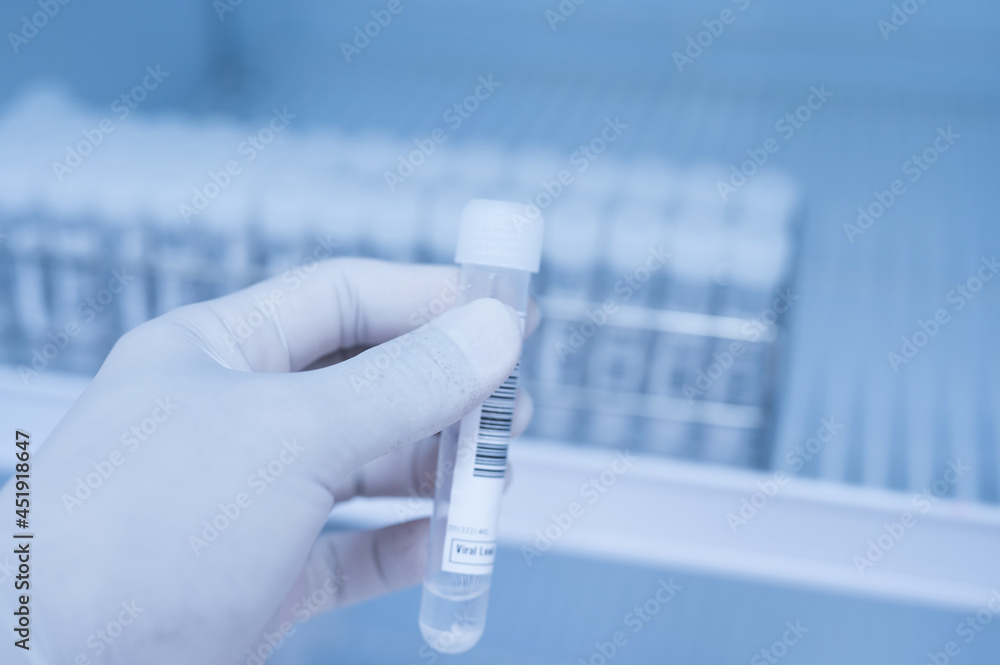 Close up scientist hand opening storage reagent container for ...