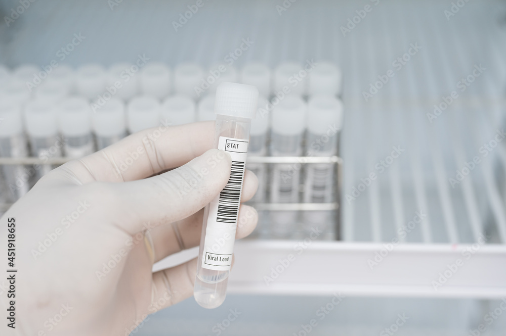 Close up scientist hand opening storage reagent container for ...