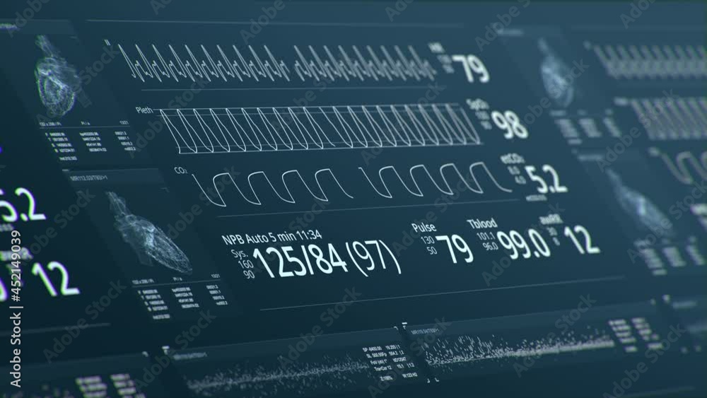 MRI scanning. Dynamic Heart beat line, pulsating heart. Cardiogram ...