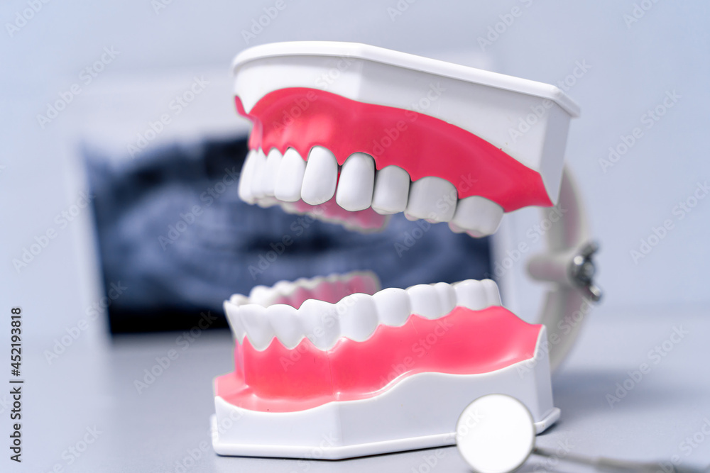 Educational model of jaw section with teeth on world map background ...