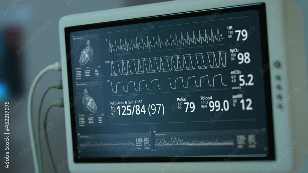 Vidéo Stock Heart beat line. Cardiogram signal monitoring process ...
