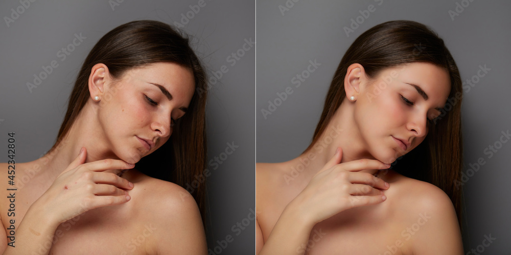 Before-after processing. Woman before and after retouch. Comparison ...