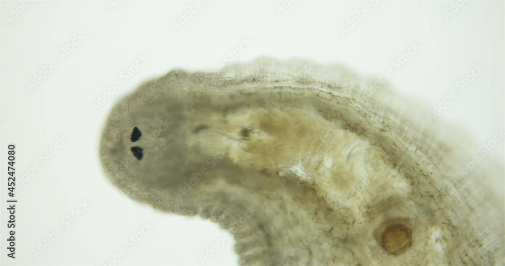 Leech family Glossiphoniidae under a microscope. Possibly species ...