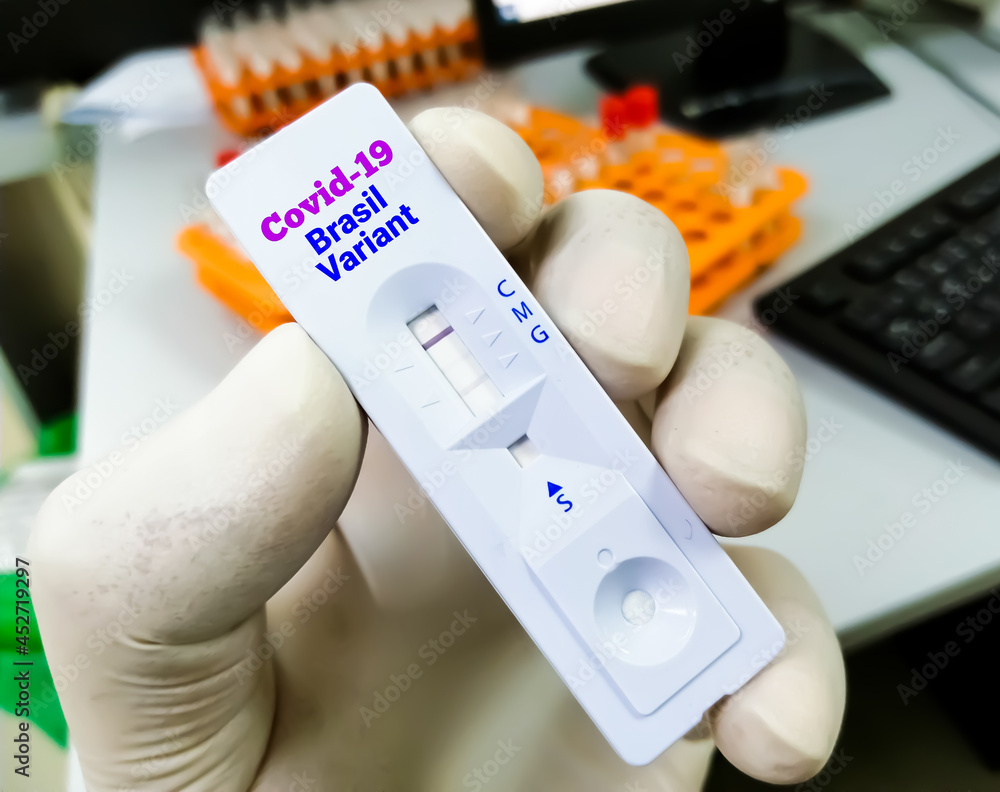 Scientist hold rapid test cassette for Covid-19 (Brazil Variant) test ...