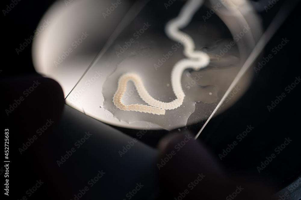The study parasite or worms is a freshwater fish parasite in laboratory ...