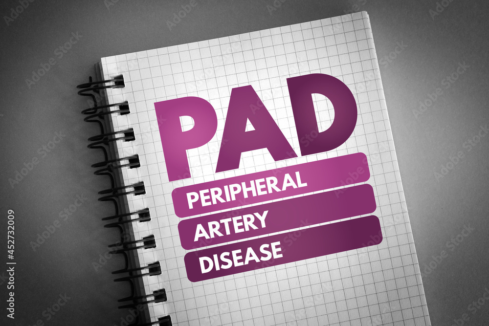 PAD - Peripheral Artery Disease acronym on notepad, health concept ...