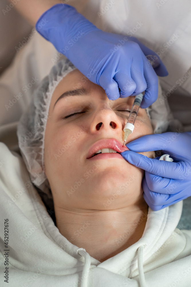 A doctor cosmetologist performs a lip contouring procedure for a young ...