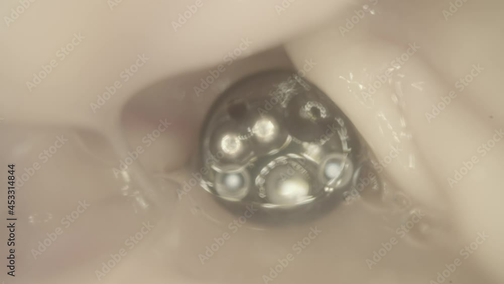 Endoscope inside the stomach. Stock Video | Adobe Stock