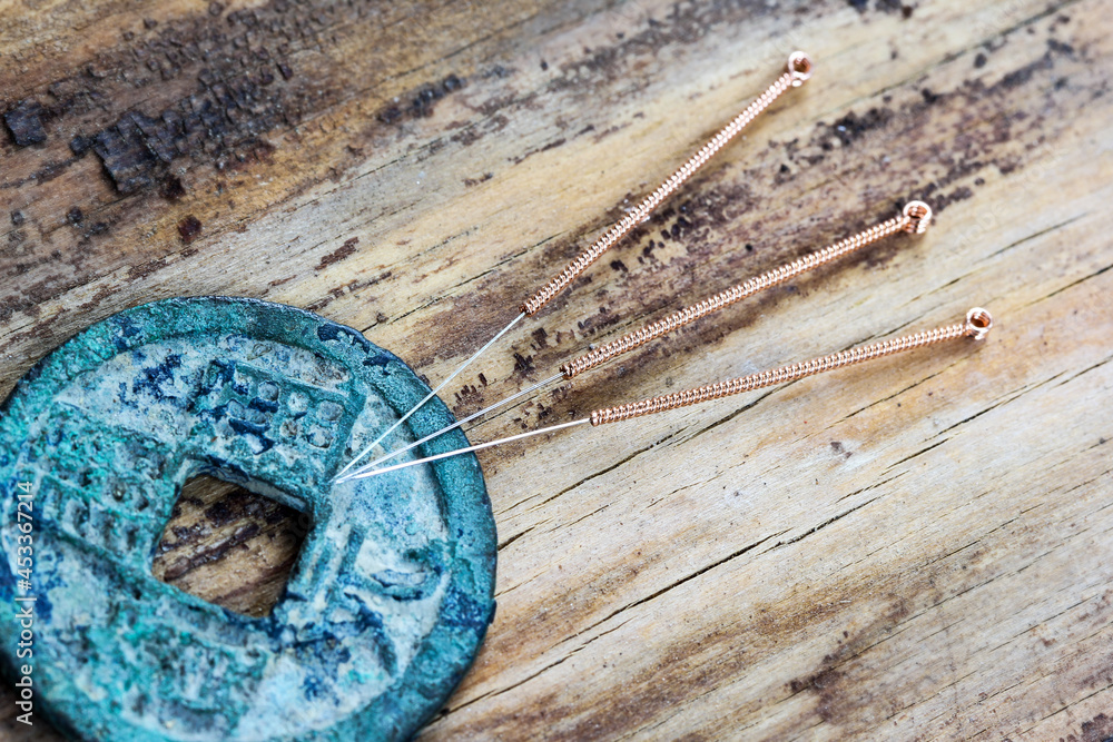 Chinese Acupuncture Needles