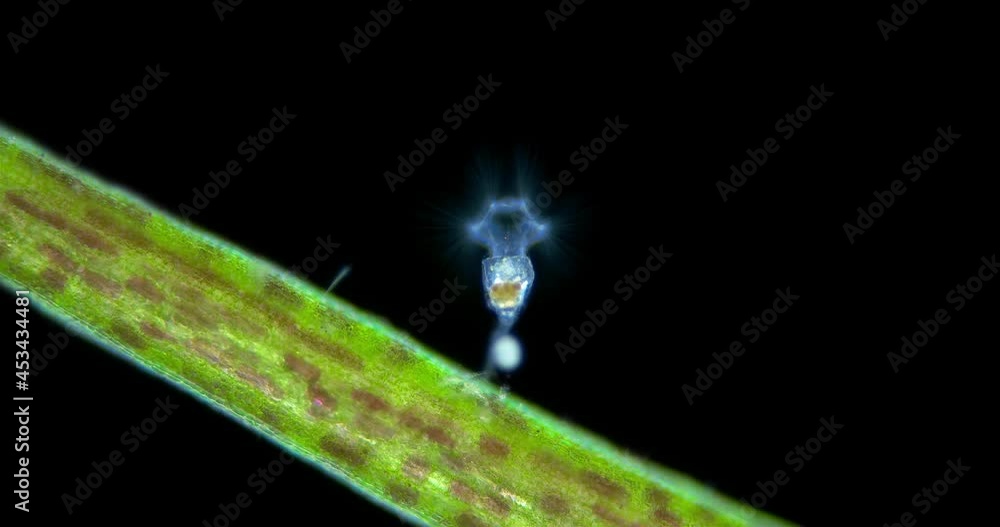 Rotifera of family Collothecidae under a microscope, possibly ...