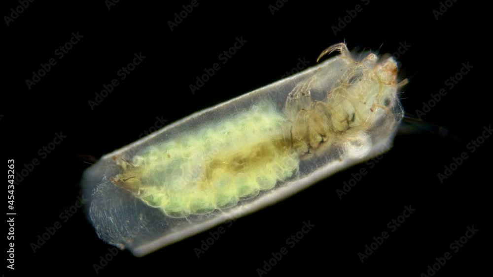 Trichoptera larva under a microscope, family Hydroptilidae. They live ...