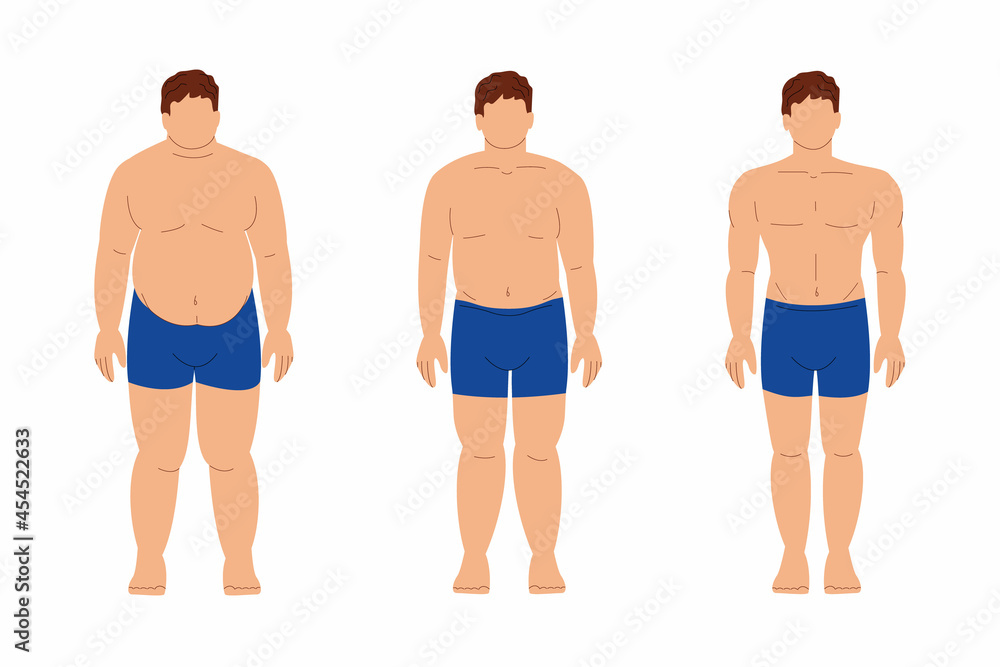 Weight loss stages. Fat obese man is losing weight. Slimming. Stock ...