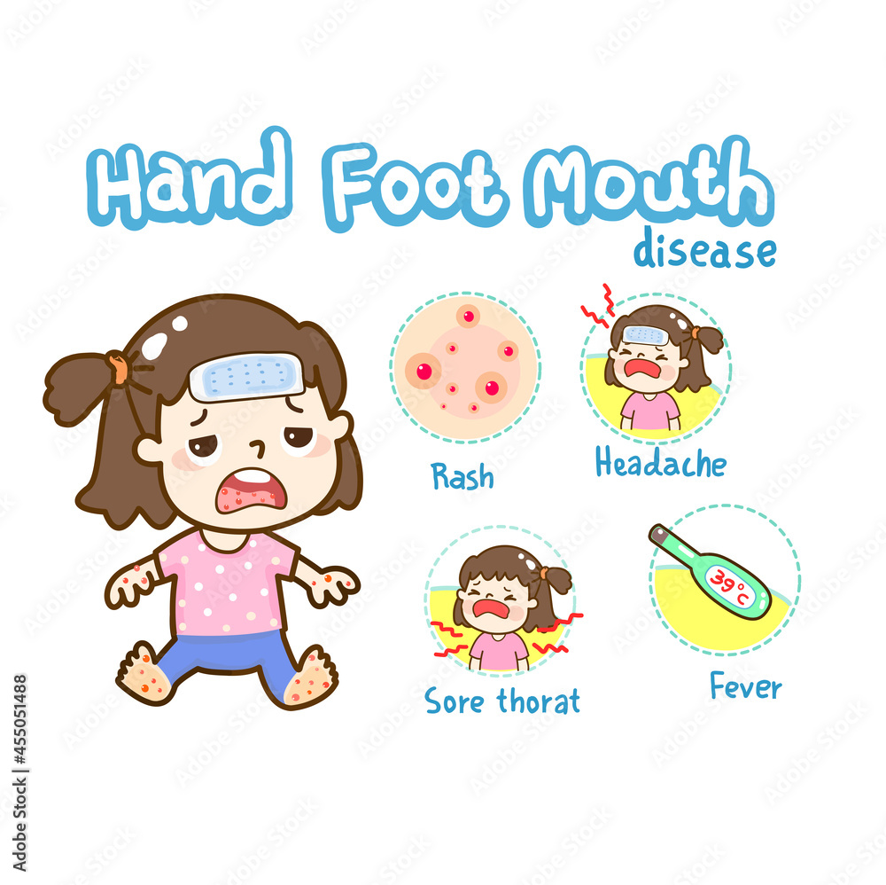 Hand Foot and Mouth Disease Stock Vector | Adobe Stock