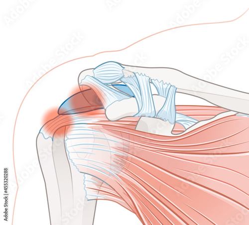Shoulder anatomy. Bursae and muscles. Vector illustration_1 Stock ...