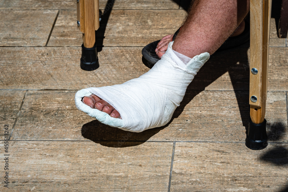 Young man in white plaster cast with broken leg and crutches sits on ...