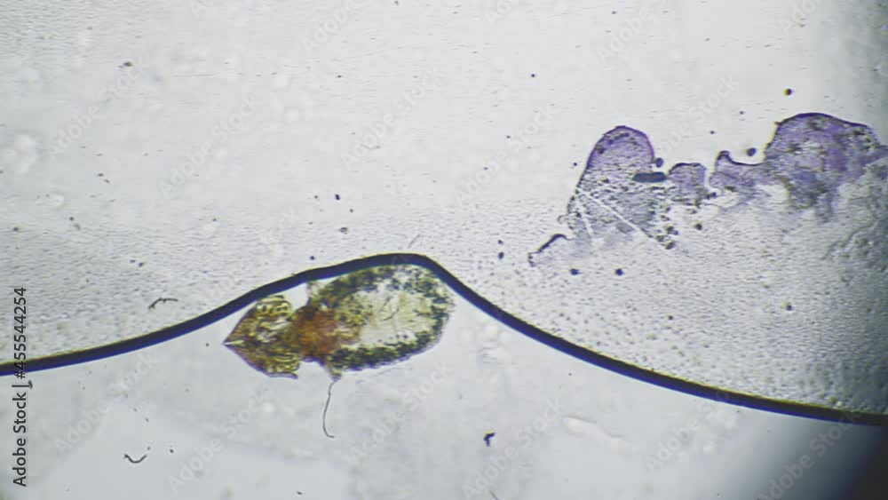 Head lice under the microscope. Skin flea under magnification. Animal ...