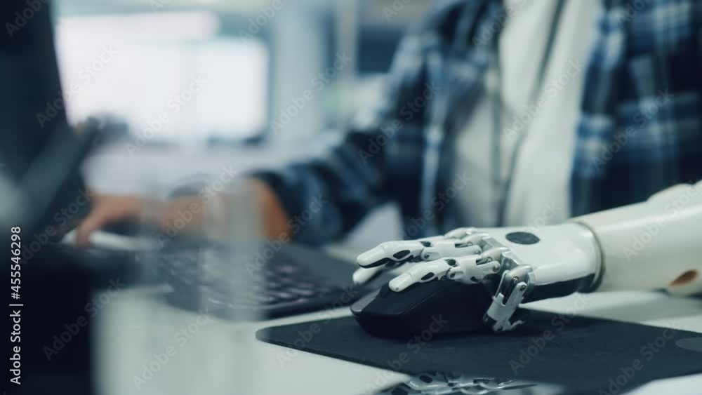 Inclusive Office: Person with Disability Using Prosthetic Arm to Work ...