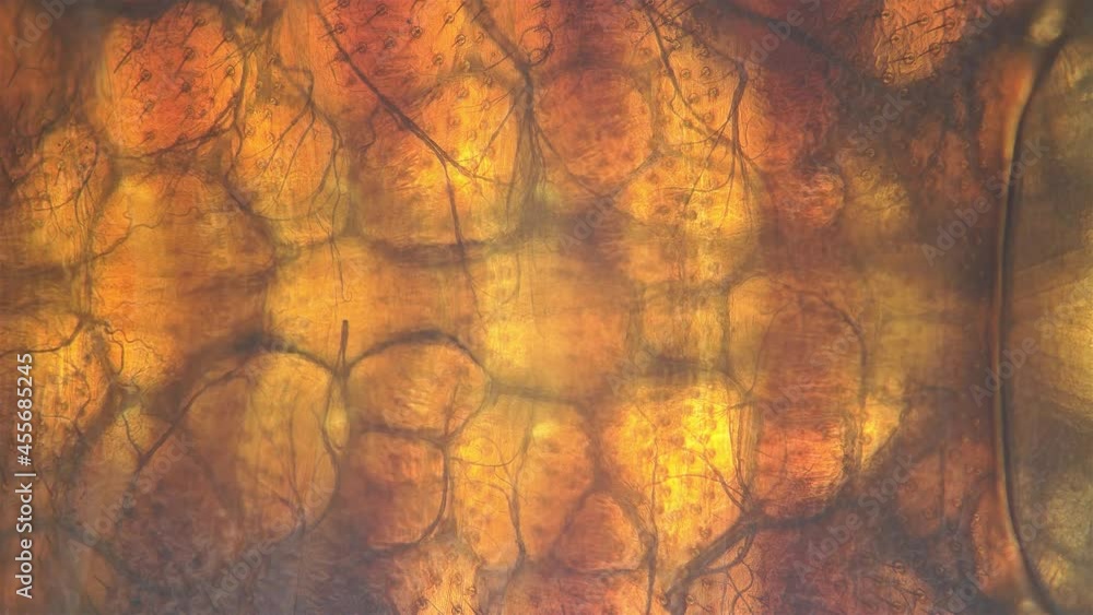 Bed bug Cimex lectularius under a microscope. Work of internal organs ...