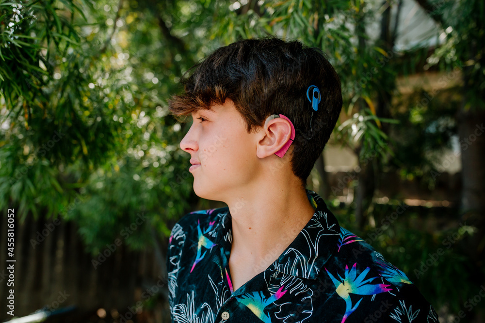 Profile of teen boy with Cochlear implants Stock Photo | Adobe Stock