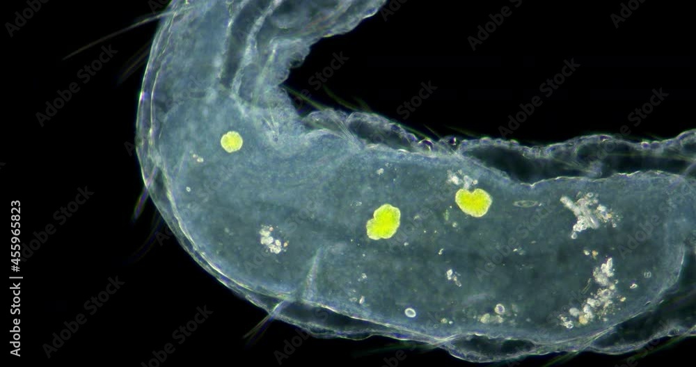 Worms Aeolosoma sp. under a microscope, Aeolosomatidae family. They ...