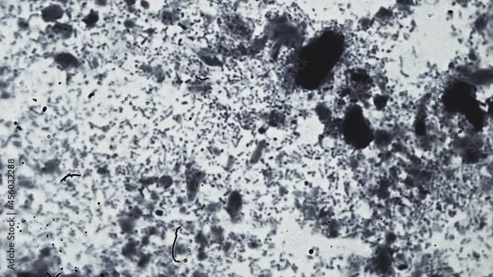 Abstract bacteria and microbes under the microscope. Fungus or mold is ...