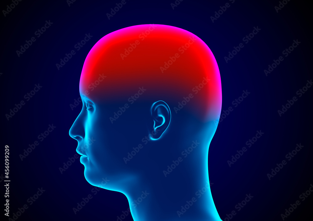 Meningitis is an inflammation of the meninges, the membranes that ...