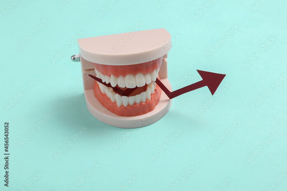 Plastic model of human jaw with growth arrow in the teeth on blue ...