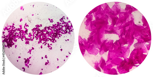 college of two microscopic image of high vaginal swab Gram stain smear ...