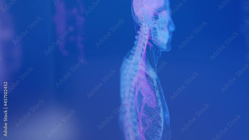 Human skeleton models on computer screen. Looking for injury ...