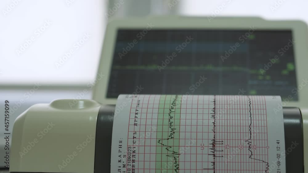 Electronic Cardiotocography Machine Monitoring Fetal Heart Contractions ...