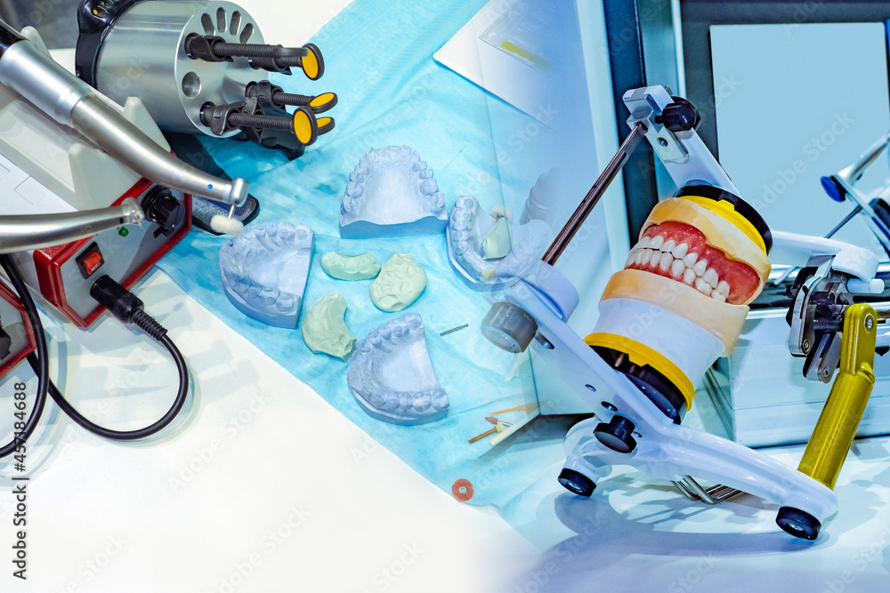 Orthodontics. Model of jaws of a man in orthodontist office. Various ...
