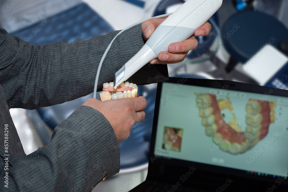 Denture scanning process. Checking teeth with an intraoral scanner ...