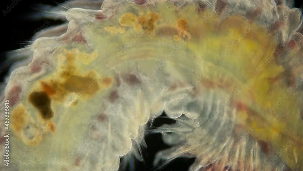 Worm Polychaeta Naineris sp. under a microscope, family Orbiniidae. In ...