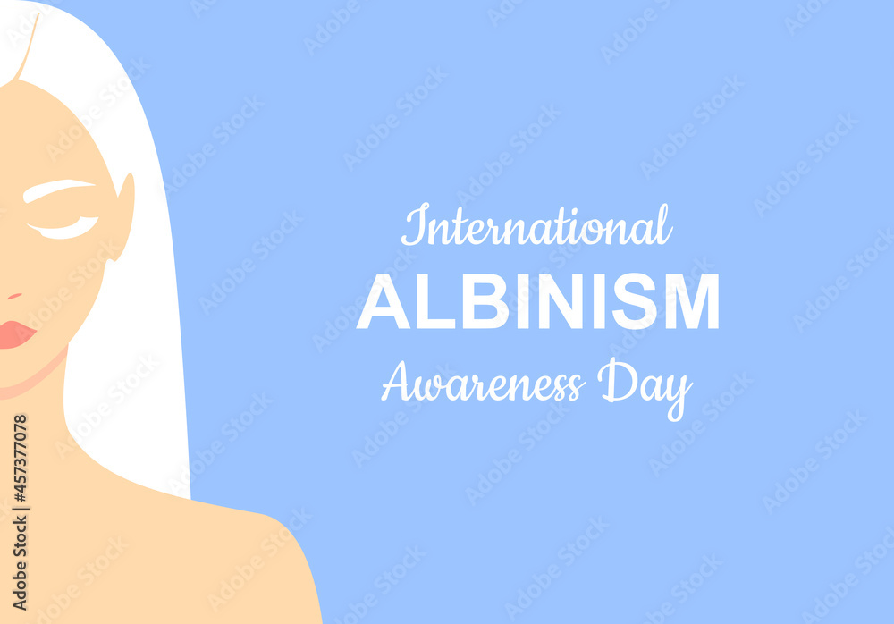 Beautiful albino woman with closed eyes on a soft blue background ...