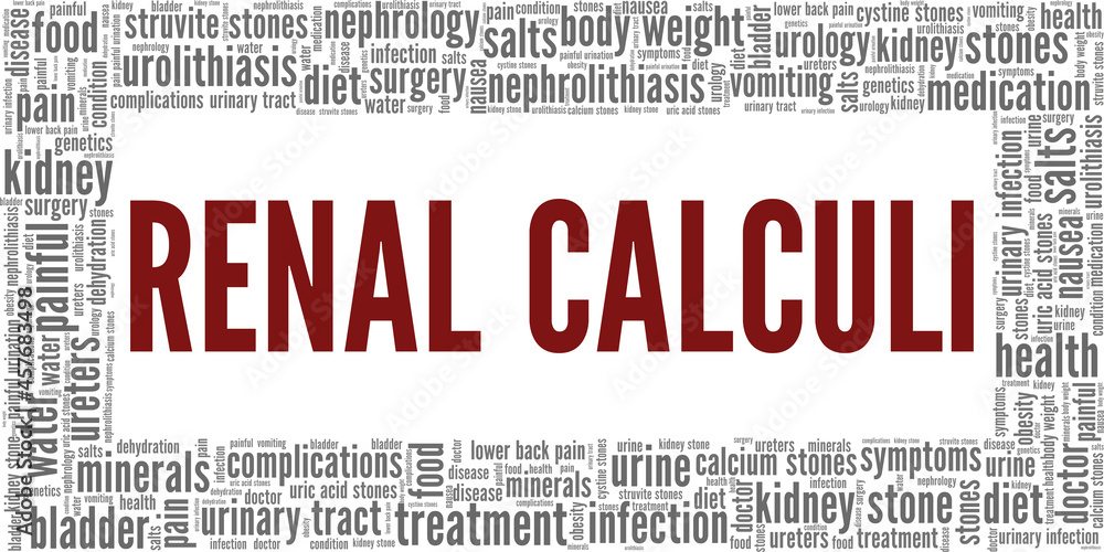 Renal Calculi vector illustration word cloud isolated on a white ...