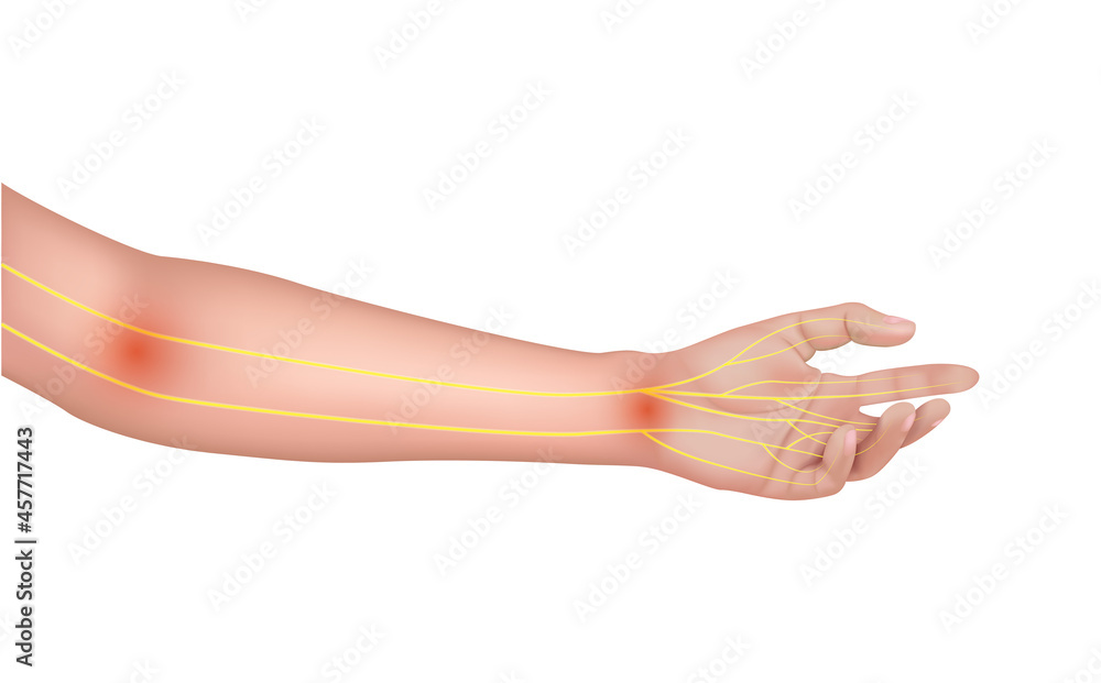 Nerve of the arm about human anatomy yellow. On a white background ...